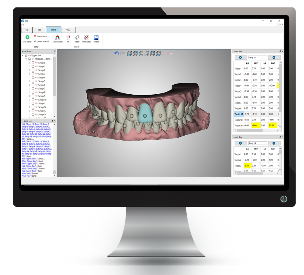 Scansmiles – Beautiful Smiles One Aligner At A Time